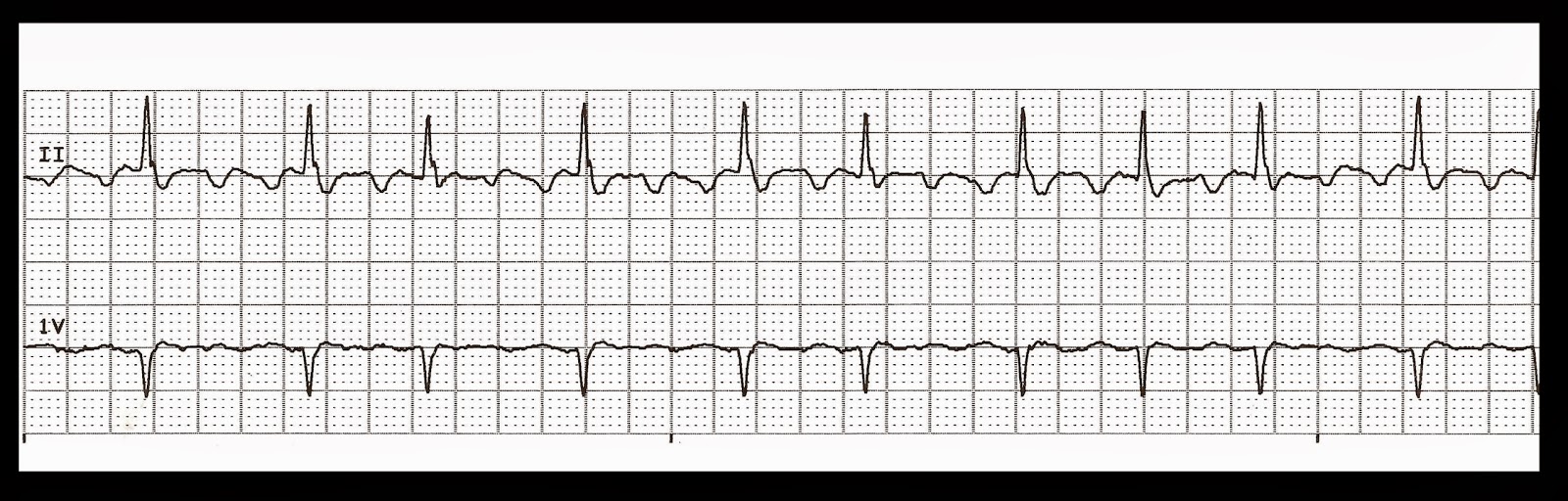 Practice EKG Strips 376