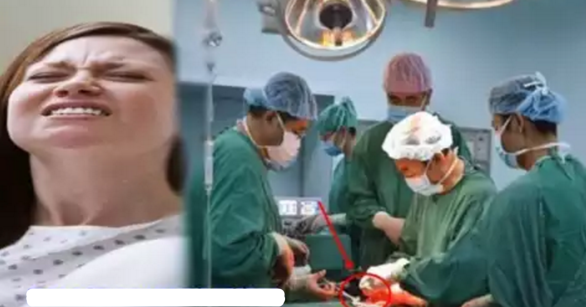 Pasca Operasi Caesar, Perut Wanita Ini Membuncit, Saat Dibedah Dokter ...