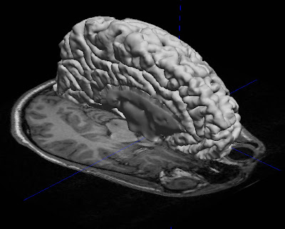 My MRI experience - pennlive.com