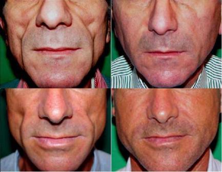 Rede Nacional de Adolescentes e Jovens Vivendo com HIV/Aids ...