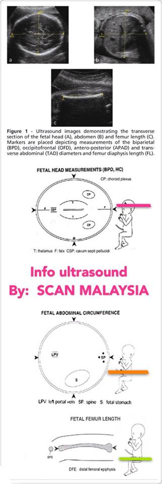 5D 6D SCAN SONOVISION: Apa itu BPD, HC, AC, FL , EFW?