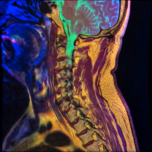 Nevit's blog: Color MRI of the Cervical verterbrae