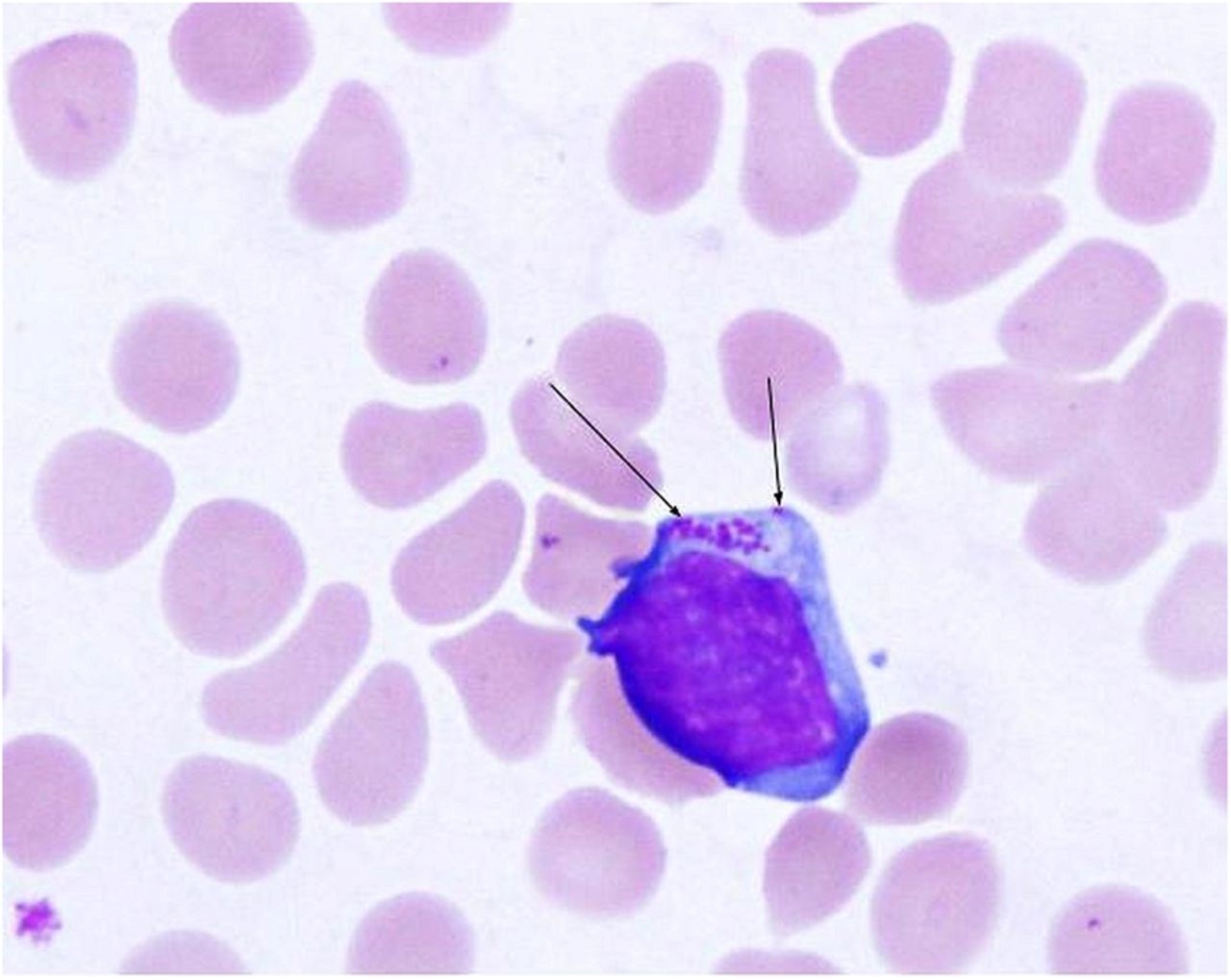 5 Cosas que no Sabias de Ehrlichia - Puerto Rico Loves Biology