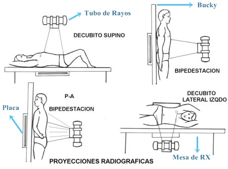 Rayos2miltrece: Proyecciones Radiológicas.