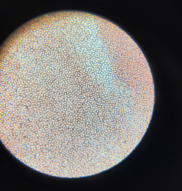 A school of fish: Blood Cells Under Microscope