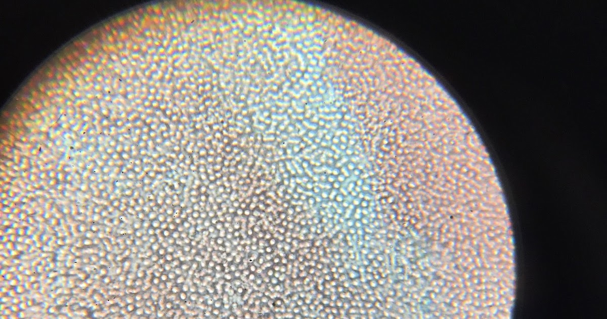 A school of fish: Blood Cells Under Microscope