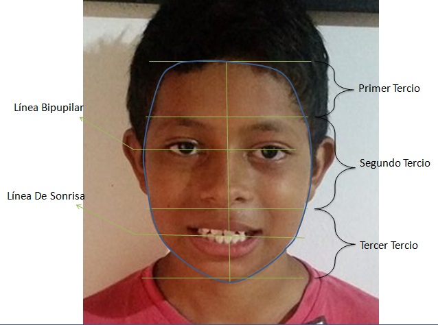 OdontoBlog Fabian López: Analisis De Sonrisa