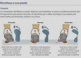4RUN Assessoria Esportiva: Tipos de Pisadas