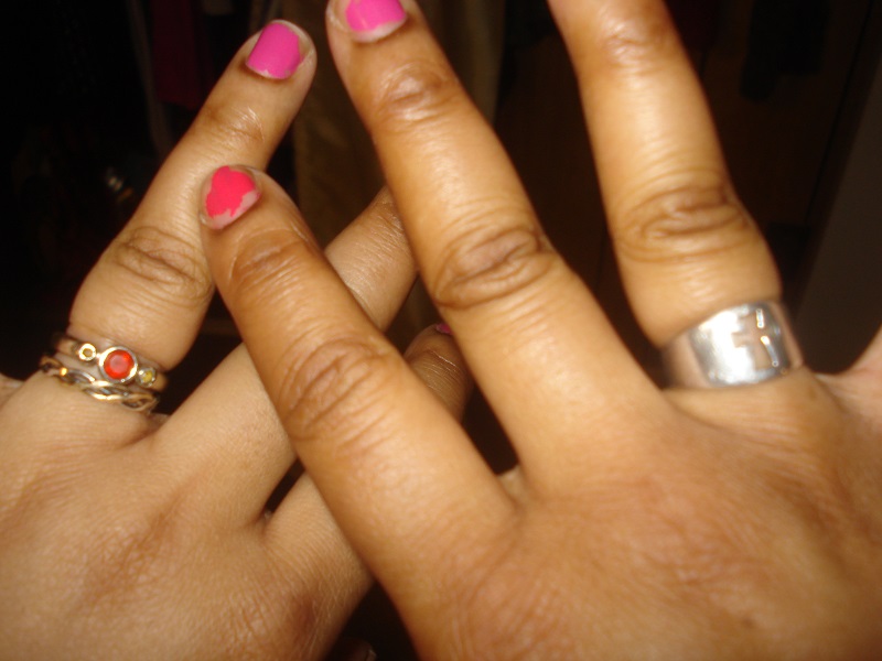 Wedding Rings Pictures: wedding ring stuck on finger