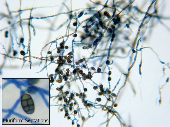 Fun With Microbiology (What's Buggin' You?): Pithomyces species