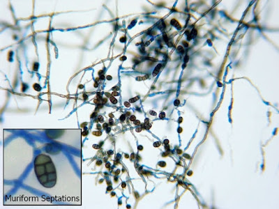 Fun With Microbiology (What's Buggin' You?): Pithomyces species