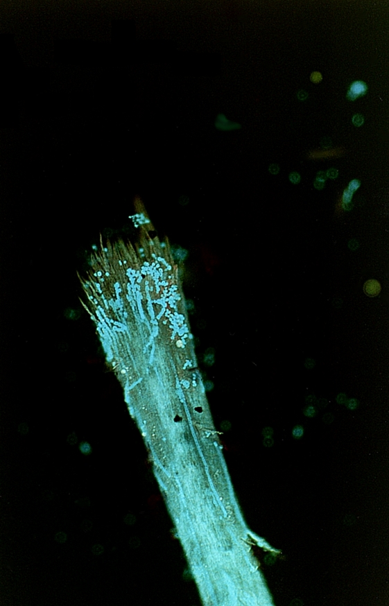 Fun With Microbiology (What's Buggin' You?): Tinea capitis: