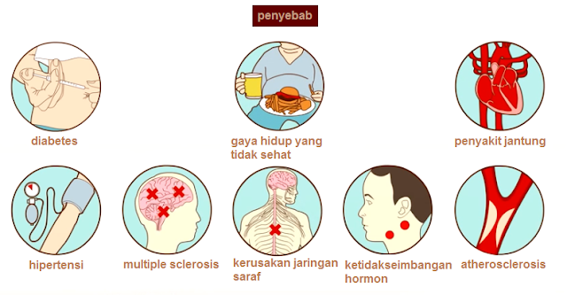 Tanda Impotensi Gejala dan Cara Mengobati Disfungsi Ereksi | Program Sehat
