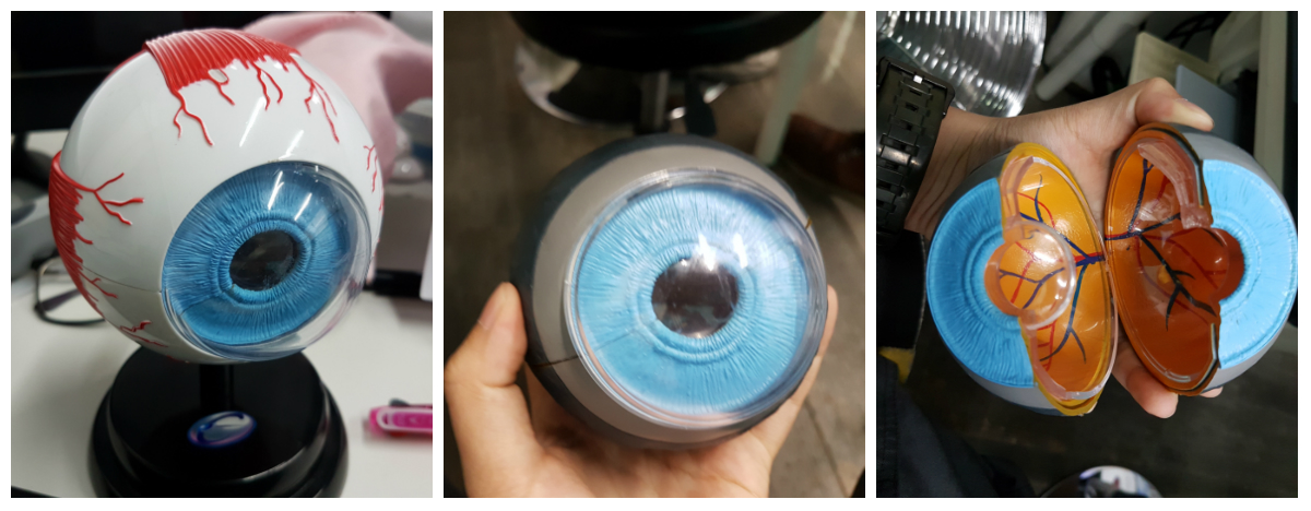 Caring for Our Eyes with AeroV : AeroV