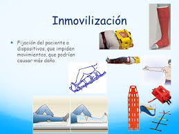 Inmovilización