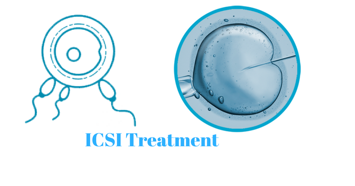 ICSI Treatment