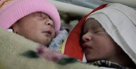 PICS N PHOTOGRAPHY: Baby born with two heads In Brazil