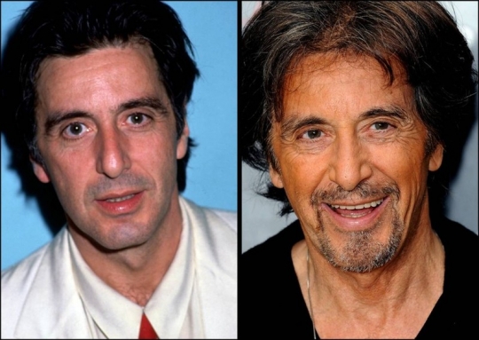 Al Pacino Plastic Surgery Before and After Botox Injections and ...