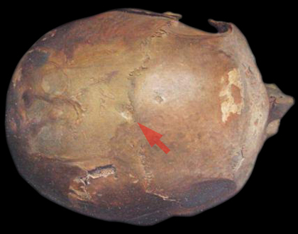 Fejér Szövetség honlapja: Béla hungár király és királyi hungaricum Belo ...