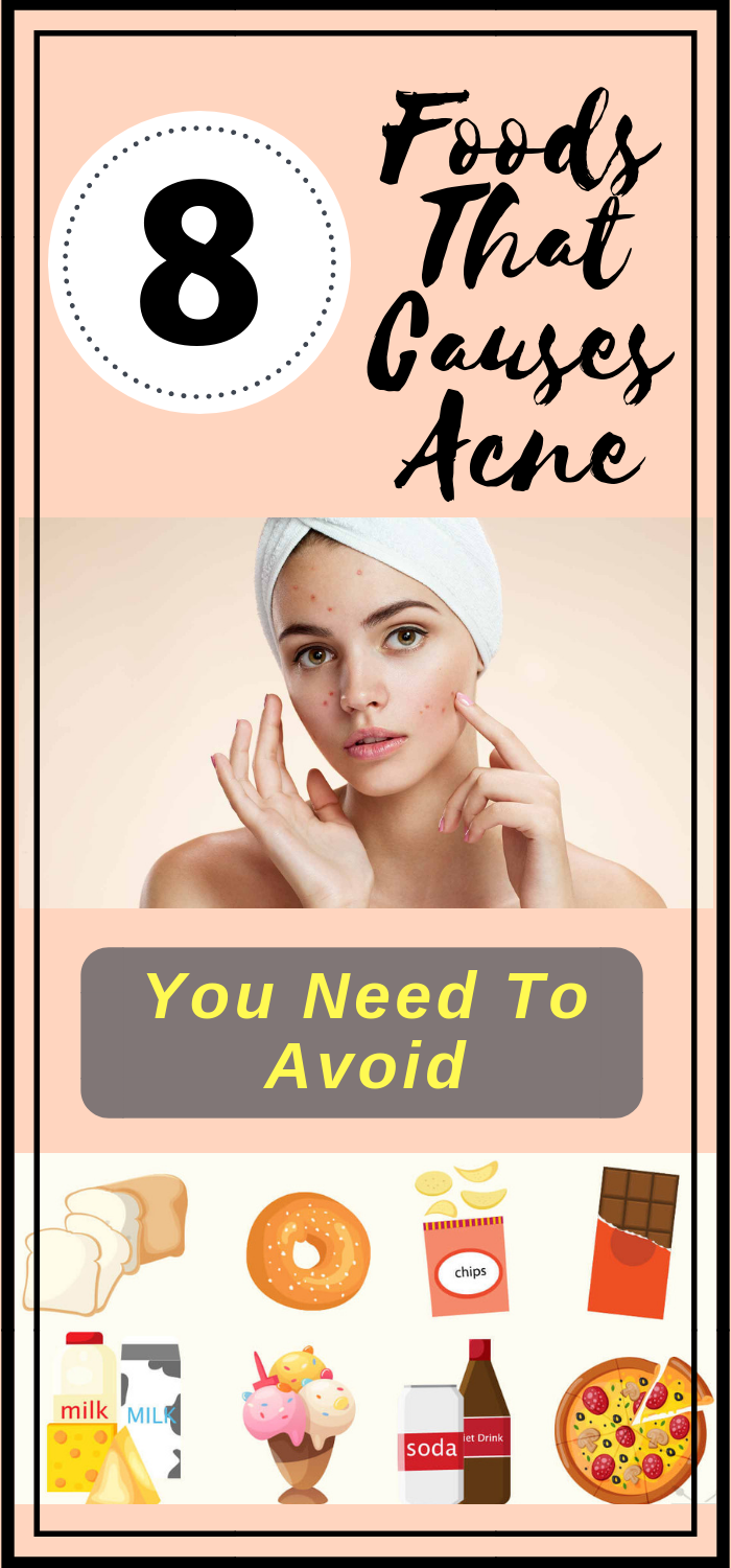 Simple Health Pocket: 8 Foods That Cause Acne & You Need To Avoid