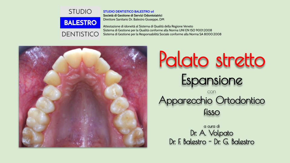 Studio Dentistico Balestro: Morso crociato laterale e posteriore