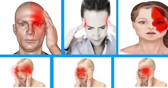 SABIAS QUE ESISTEN DIFERENTES TIPOS DE DOLORES DE CABEZA Y TRATAMIENTOS ...