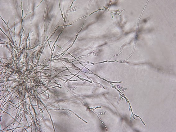 Fun With Microbiology (What's Buggin' You?): Trichosporon species