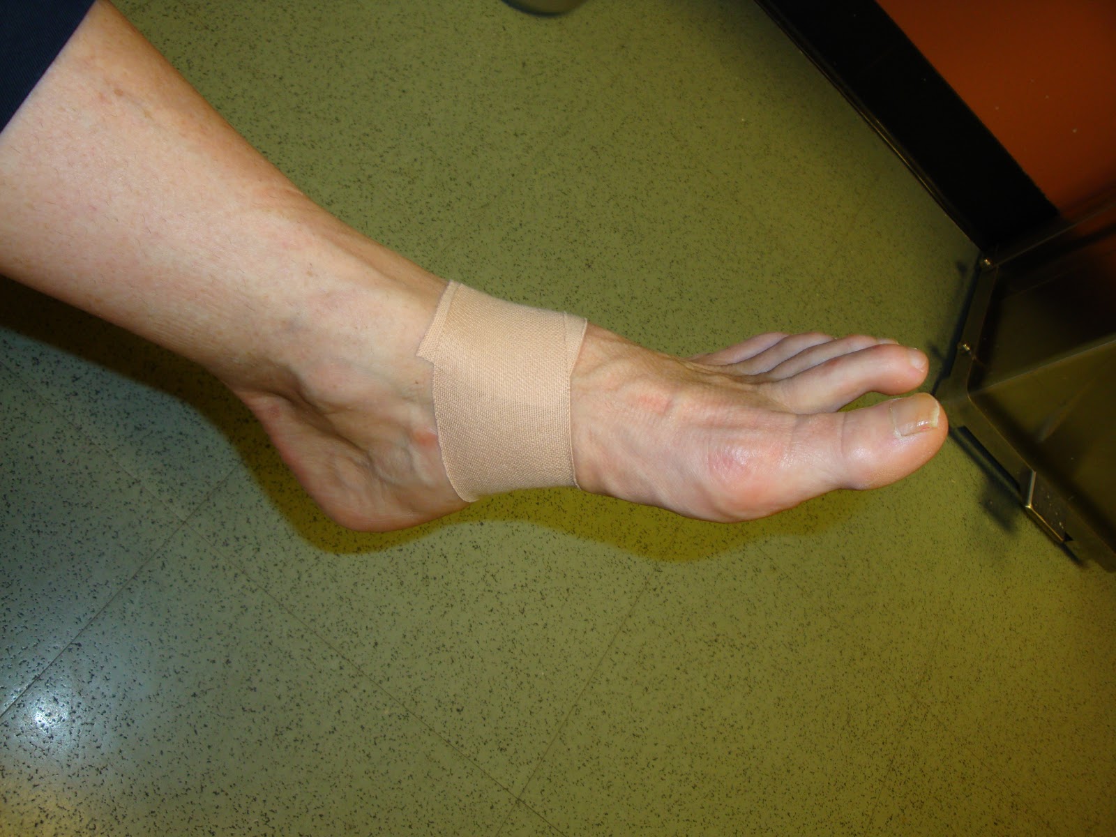 Foot and Ankle Problems By Dr. Richard Blake: Kinesiotape Advice from ...