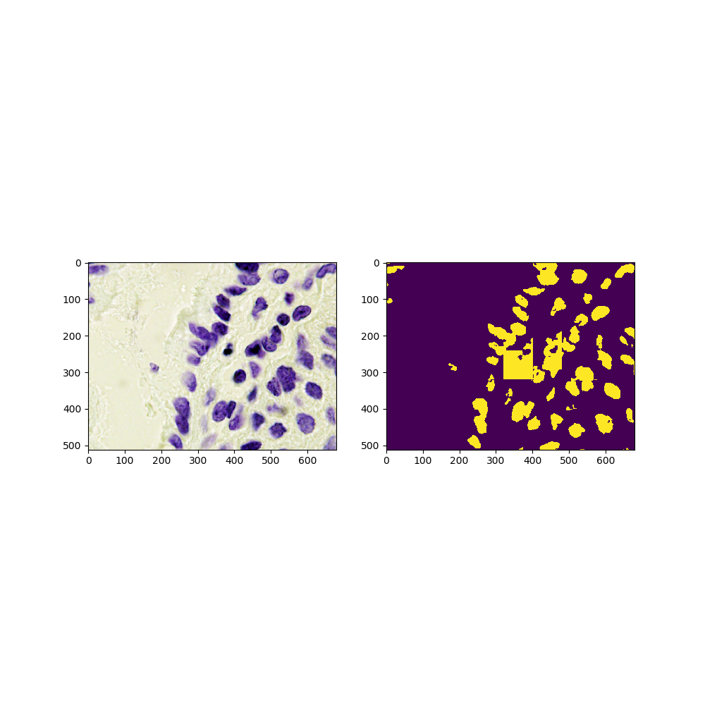 Learning Deep Learning Data science bowl 2018 Trainen learning-deep-learning-data-science-bowl-2018-trainen