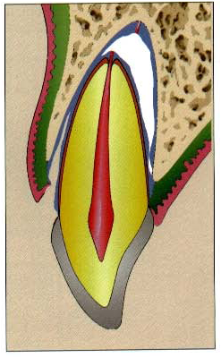 Dental Care: Classification of Dental Trauma