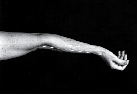 EL RINCÓN DE LA MEDICINA INTERNA. juanpedromacaluso@yahoo.com.ar ...