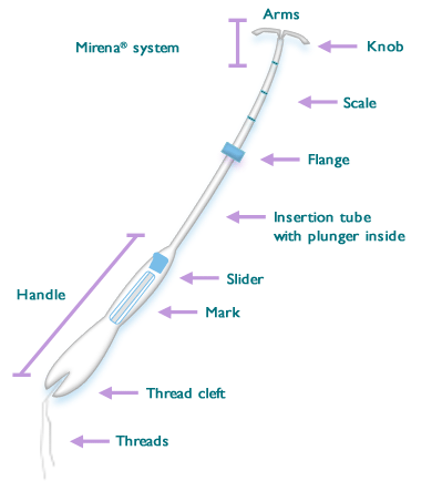 The Swallow Flies: IUD (TMI), Part II