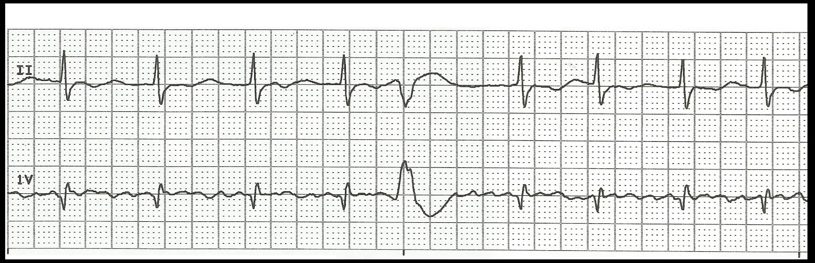 ECG Rhythm Strip Quiz 112