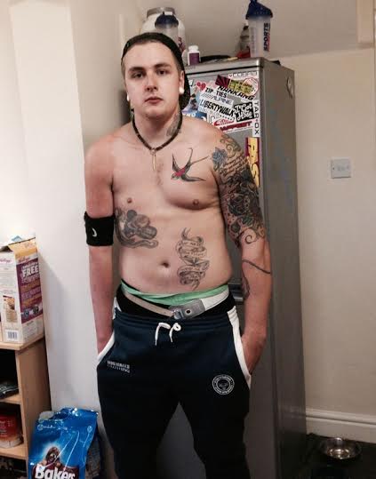 Motorcylist who broke his back, lost his leg and arm becomes a ...