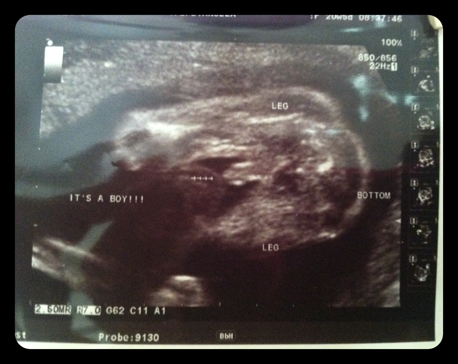 Keith&Angie: 21 weeks & baby L's Gender Reveal.