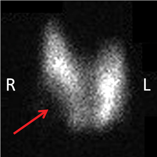 Lecture Notes in Medical Technology: Lecture #6: THE ENDOCRINE SYSTEM