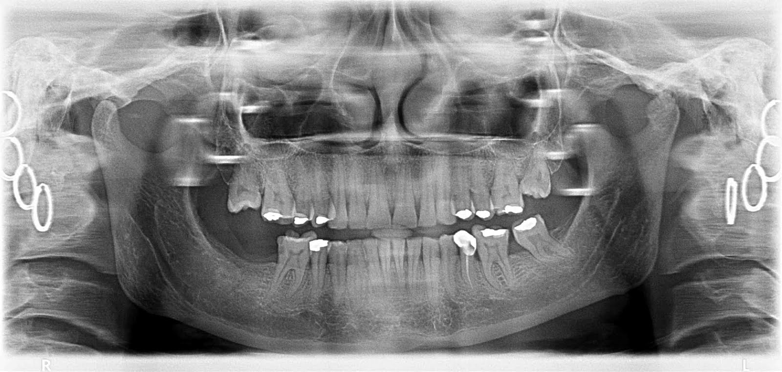 Restorative Dentistry & Endodontics