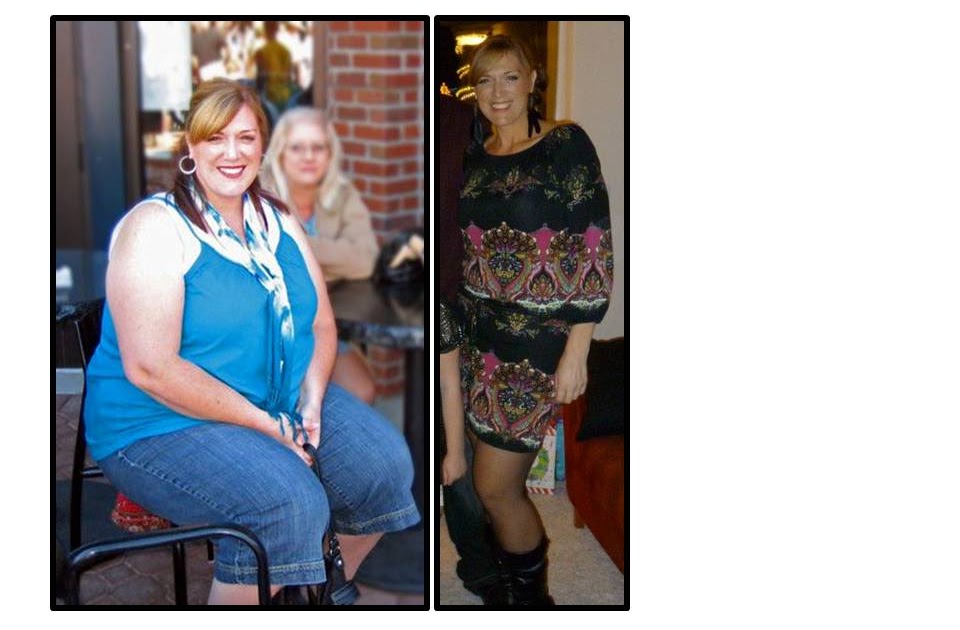 Sandy's Journey: Weight Loss Before and After
