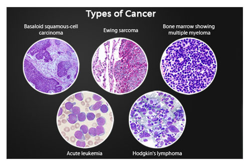 jobsanger: August 2015