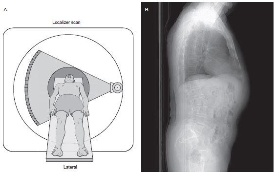 What is Localizer on CT Scan - RadTechOnDuty