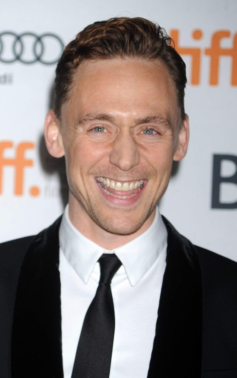 Tom Hiddleston Teeth