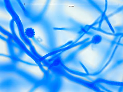 Fun With Microbiology (What's Buggin' You?): Sepedonium species