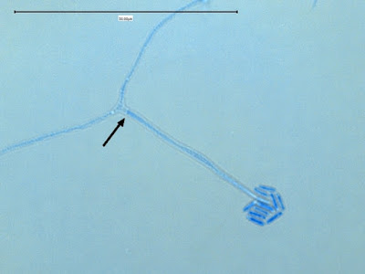 Fun With Microbiology (What's Buggin' You?): Sarocladium kiliense