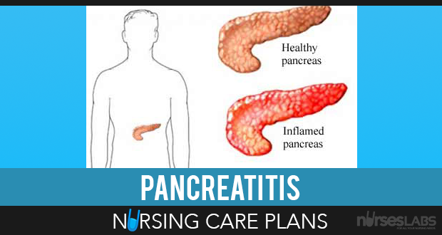 3 Pancreatitis Nursing Care Plans | Nursing Care