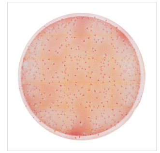 PHARMACEUTICAL MICROBIOLOGY: TNTC and TFTC