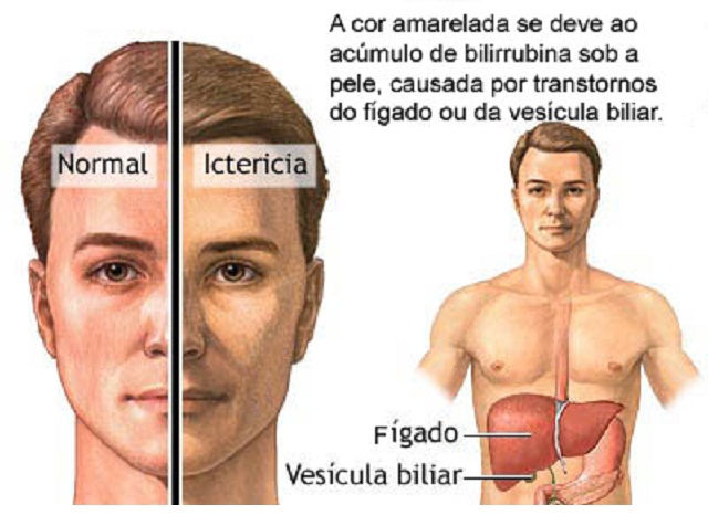 Biomédicos em Busca da Saúde: Diagnóstico da Hepatite B