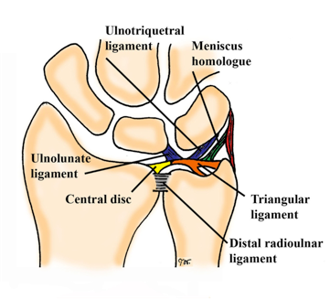 Tfcc Ligament Tear Repair - delggett