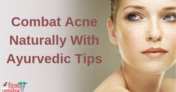 Divya Upchar: Combat Acne Naturally With These Ayurvedic Tips