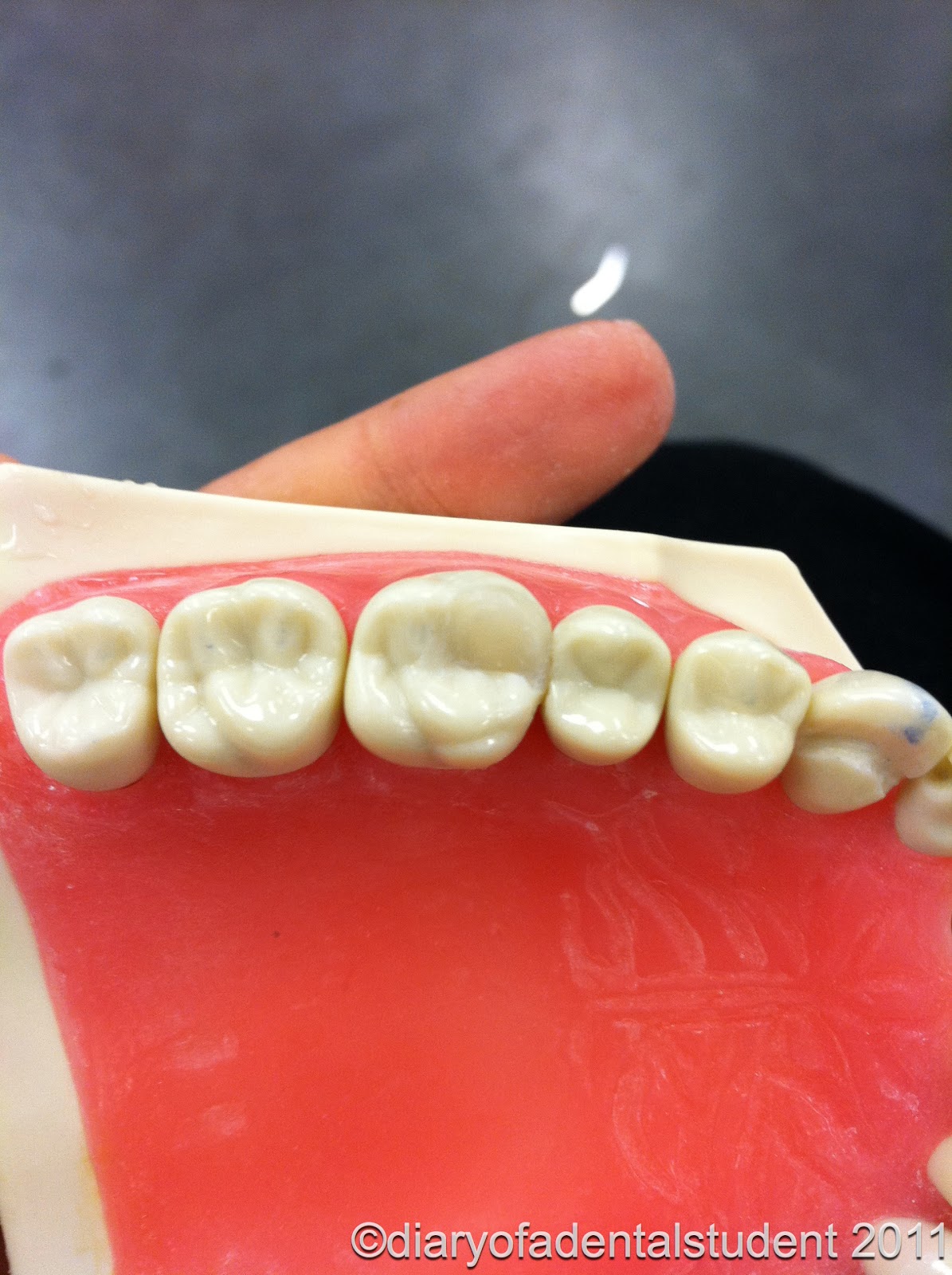 diary of a dental student: I spy...