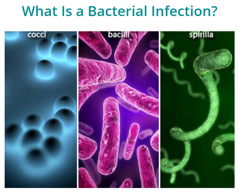 ‘Keep the cell wall shut’ model to fight bacterial infection - Seeker's ...